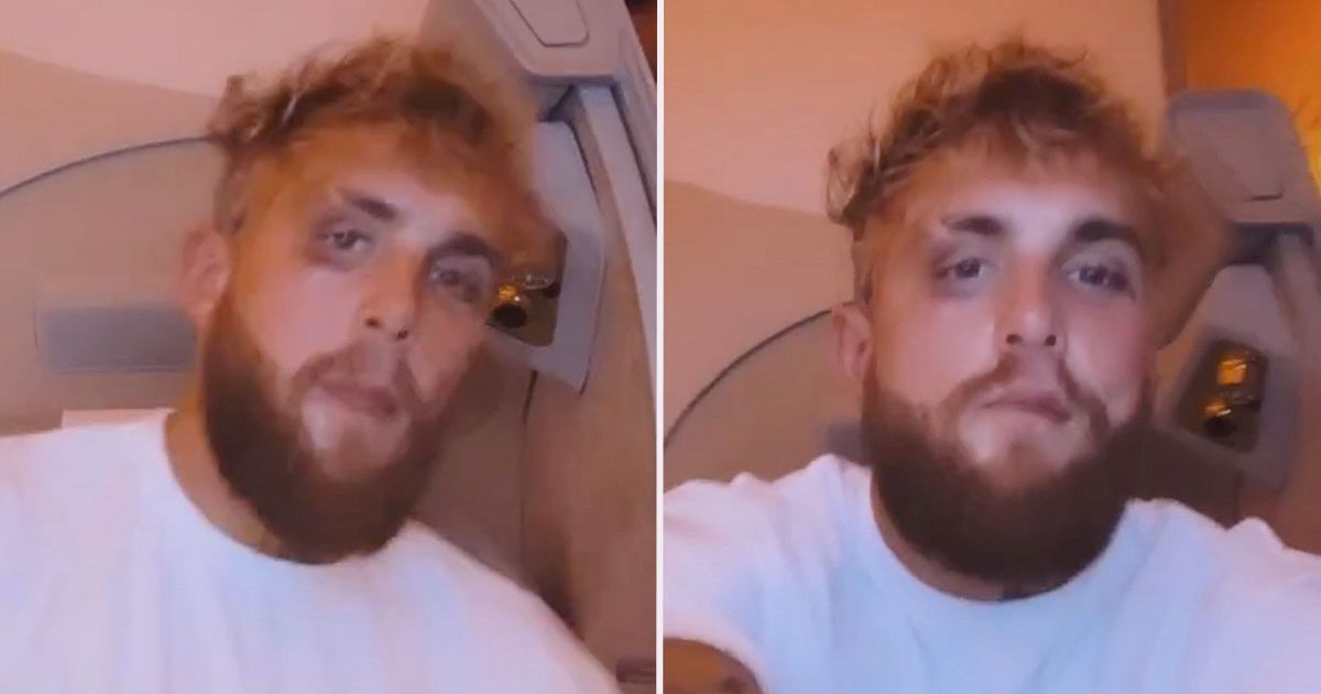Jake Paul shows off black eye he suffered in boxing…
