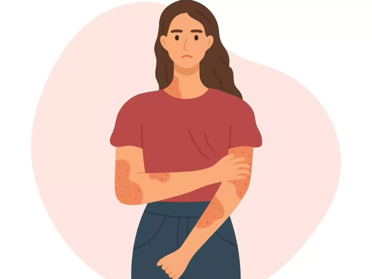 Shingles Awareness Week 2023: What you need to know…