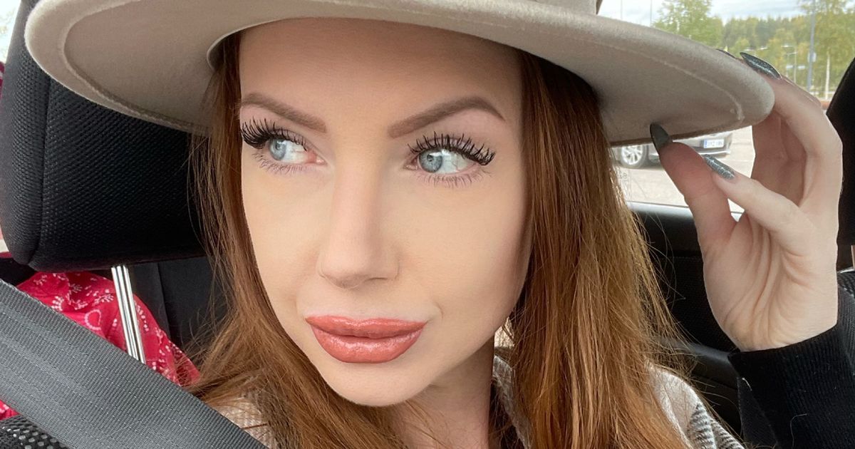 Finnish model spent £3k on botched surgery which…