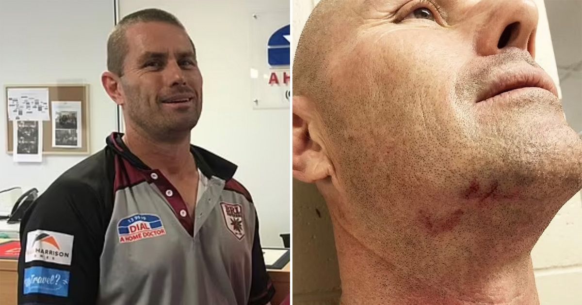 Rugby league referee hospitalised after being kicked…