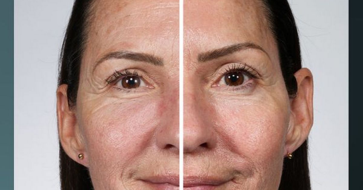 Woman ditches foundation after using Boots No7's 'most…