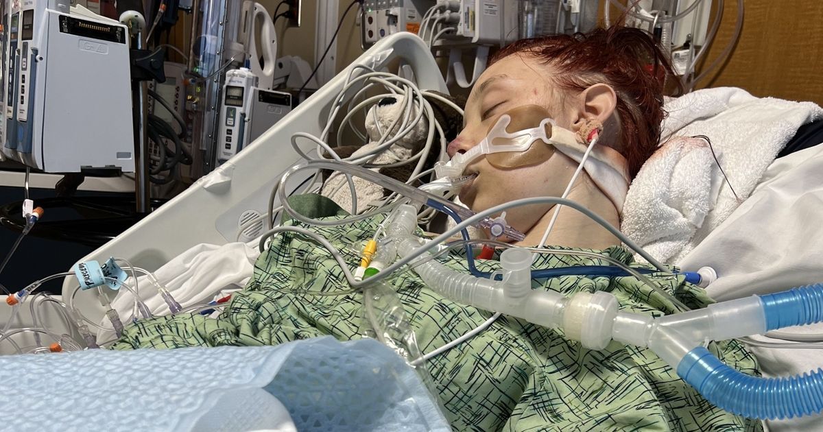 Woman loses all four limbs after catching disease from…