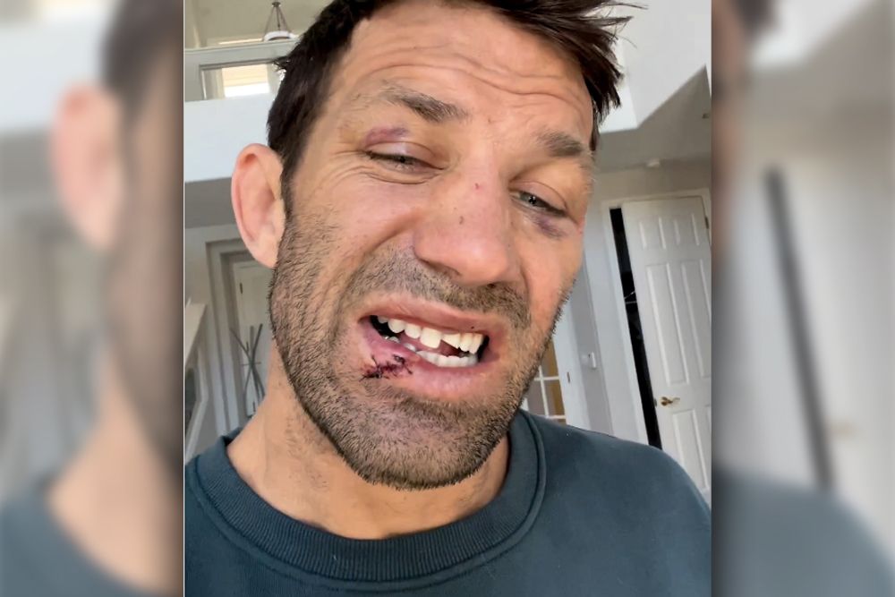 Luke Rockhold shows tooth damage after BKFC 41 loss…