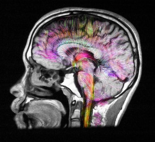 What Does Ozempic Really Do To Your Brain? Scientists…