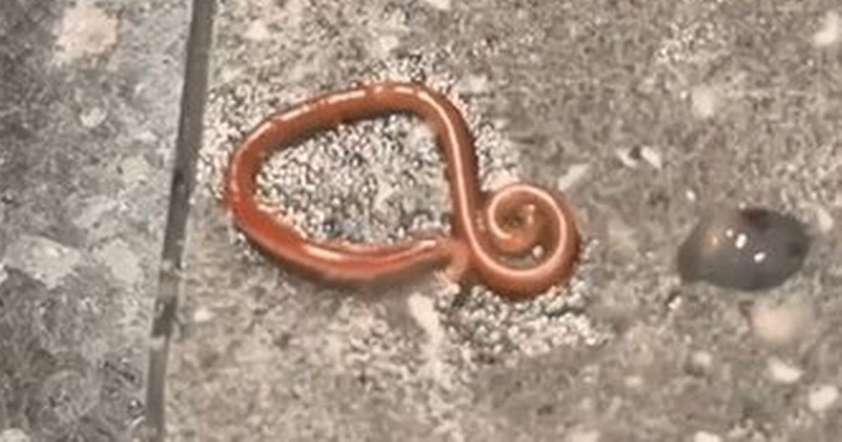 Woman 'sick to her stomach' as live worms wriggle out…
