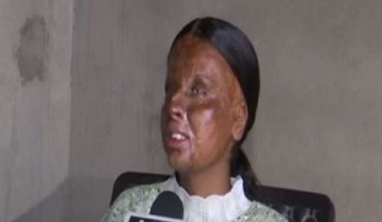 Acid attack survivor, a peon's daughter, tops in…