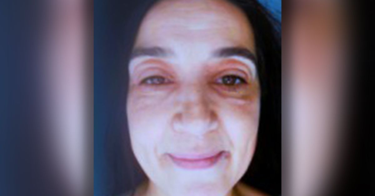 Mum-of-two looked like 'swollen toad' because of this…