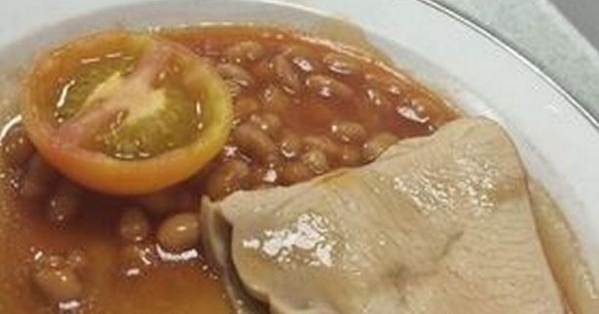 Grim photo shows 'shocking' hospital food that forced…