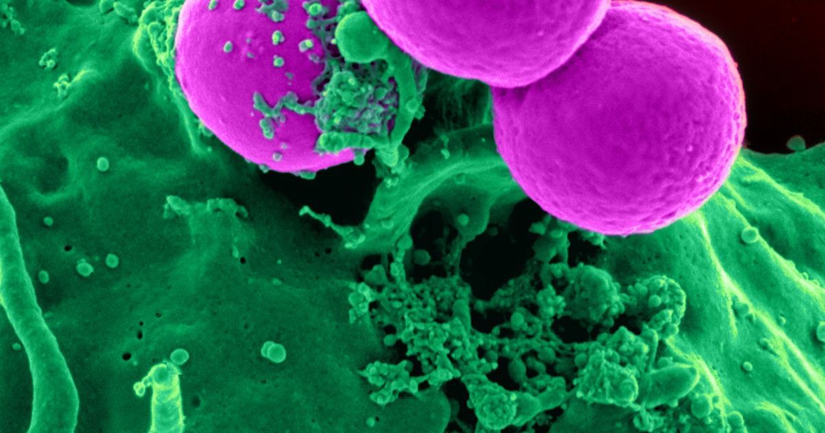 Deadly brain-eating amoeba is spreading north thanks…