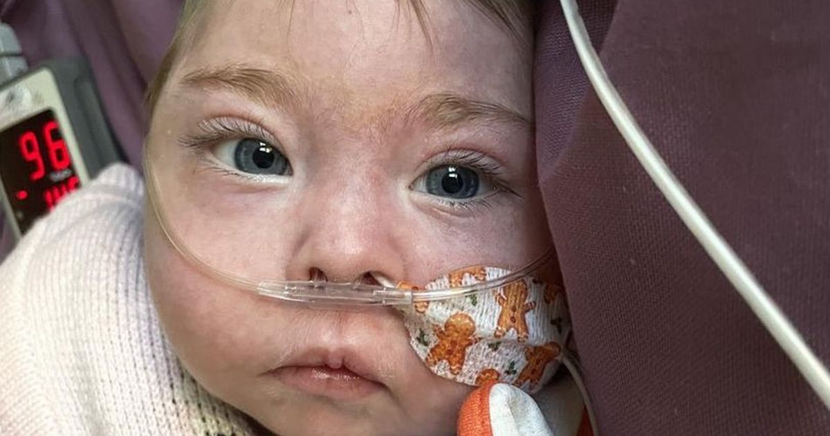 'My baby has a rare genetic disorder - there are times…
