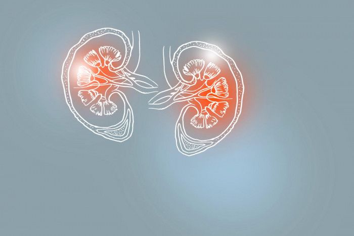 High creatinine levels can indicate chronic kidney…