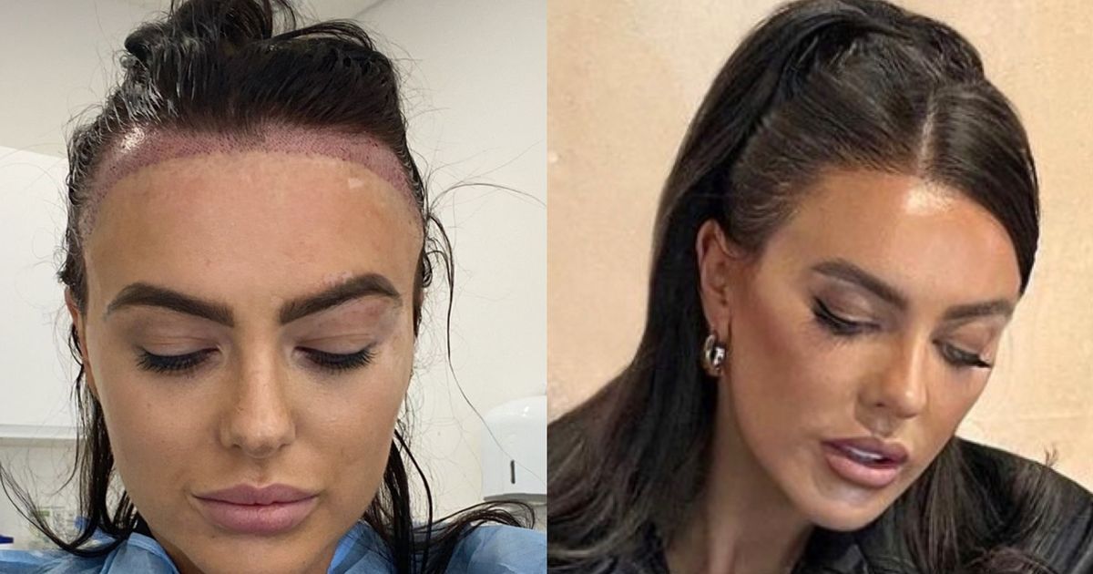 Celebrity surgeon says more women are having hair…