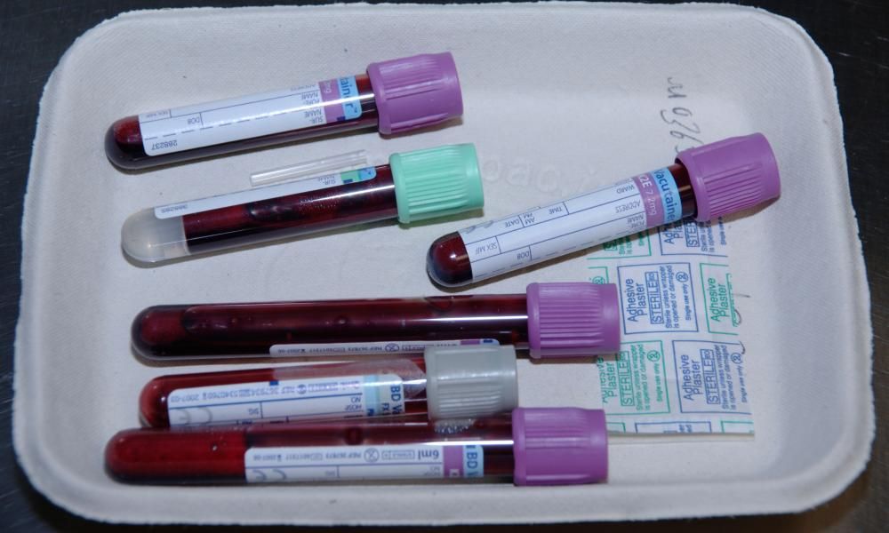 Blood test for 50 types of cancer could speed up…