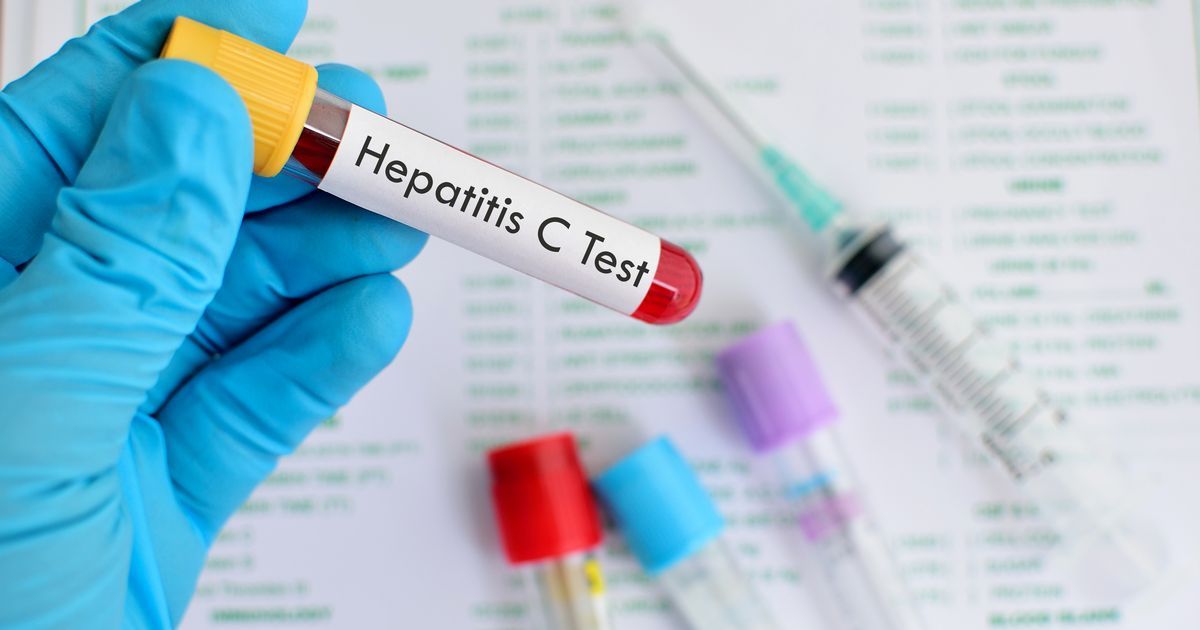 Hepatitis C symptoms, how to test at home and…
