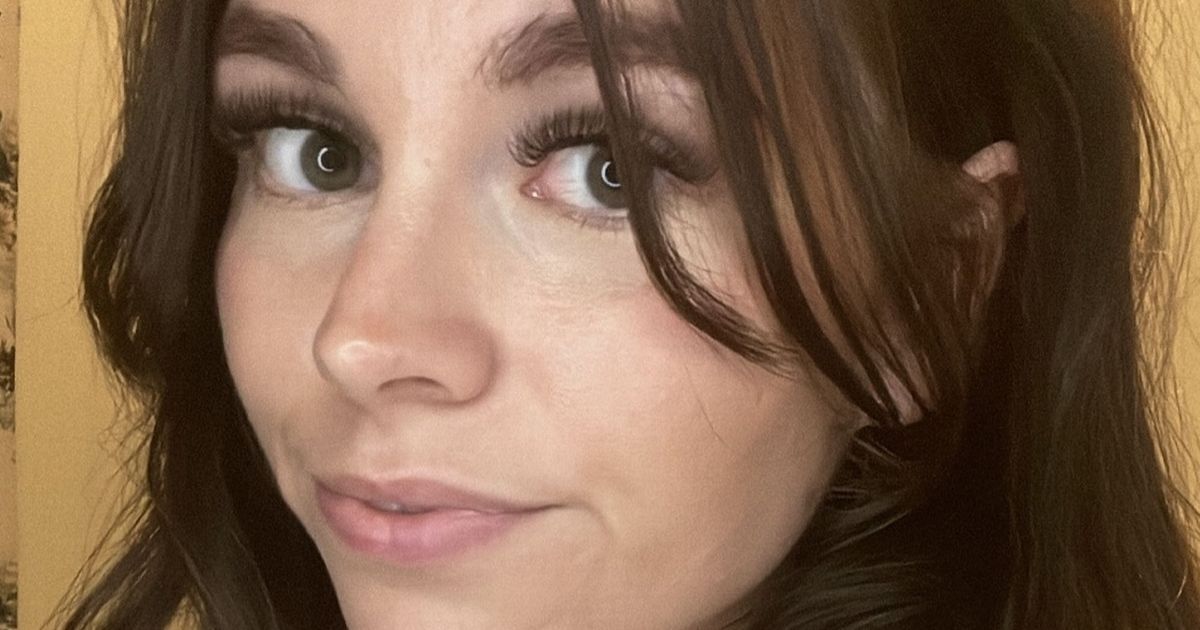Woman Forced To Wear Gloves All Summer After Suffering woman-forced-to-wear-gloves-all-summer-after-suffering