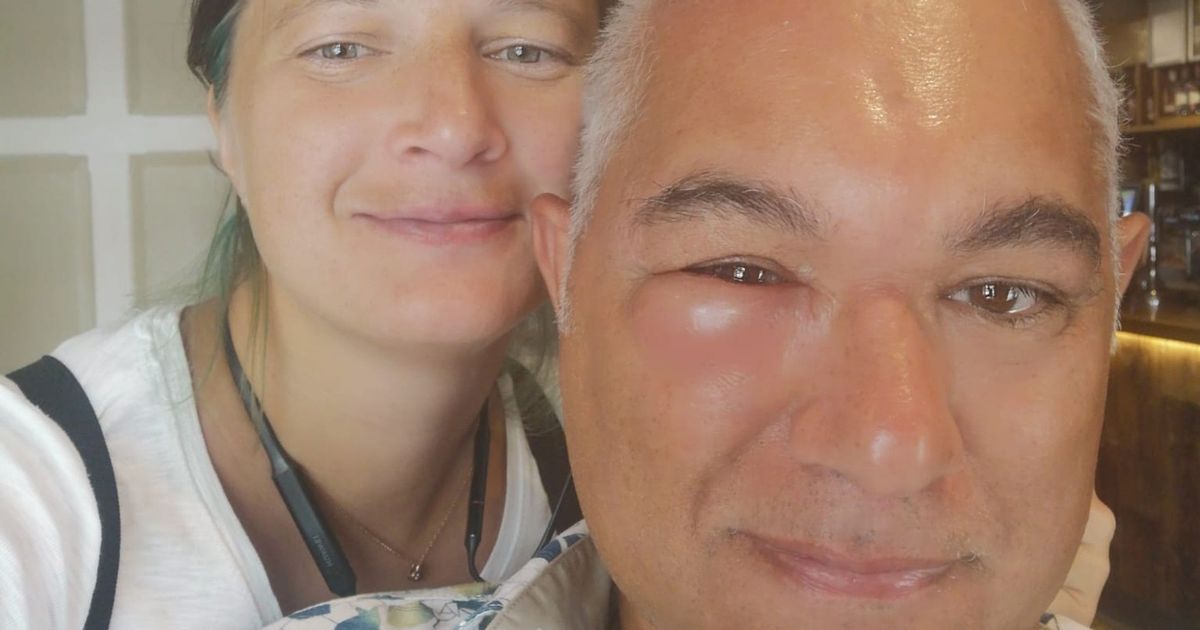 Horrified camper bitten on the HEAD by UK's only…