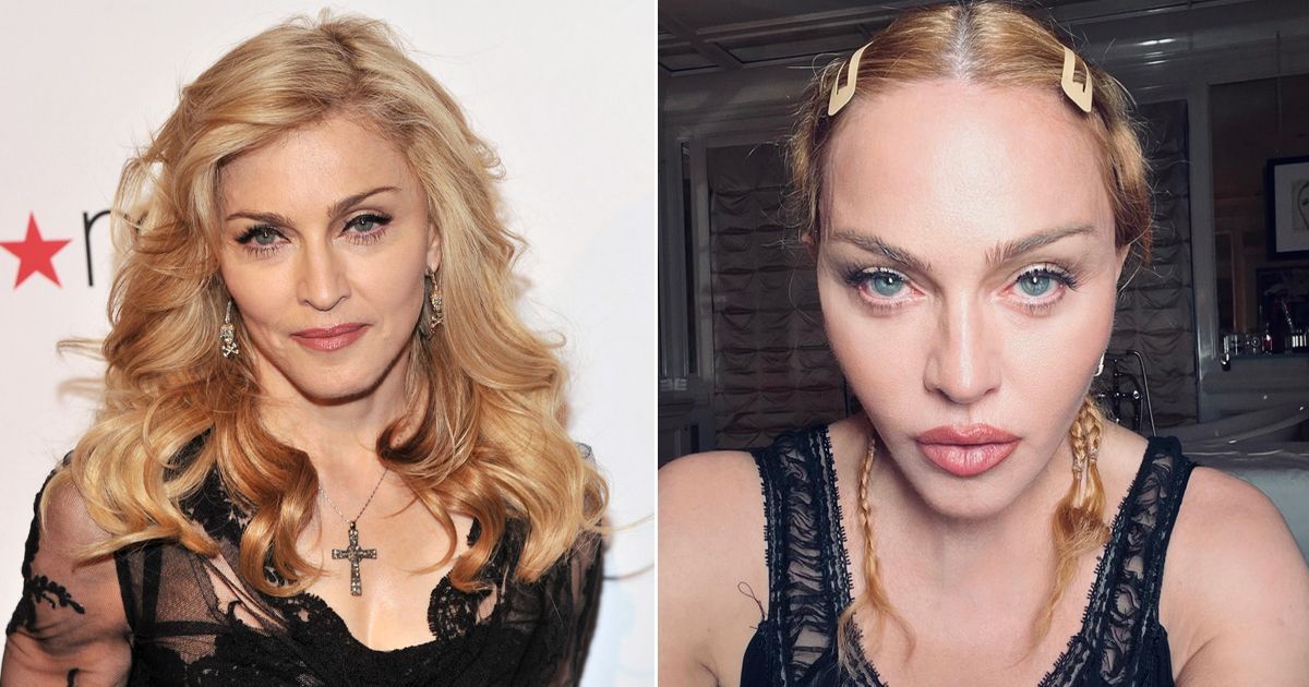 Madonna urged to realise 'surgery won't stop ageing'…