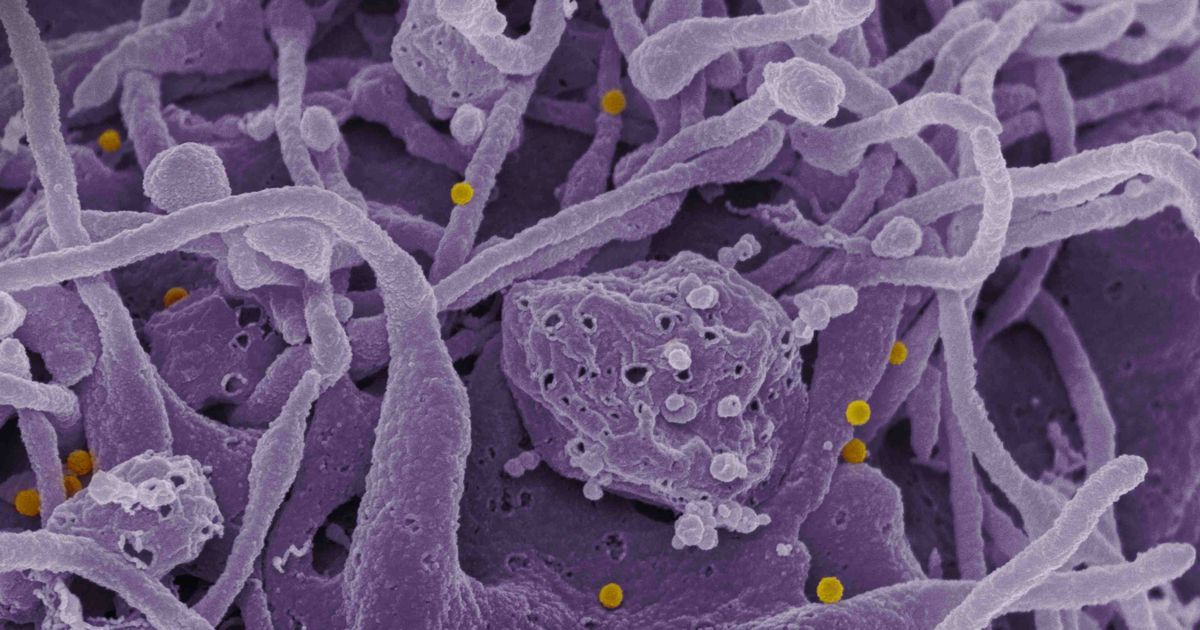 Symptoms of lethal virus spreading in Europe and…