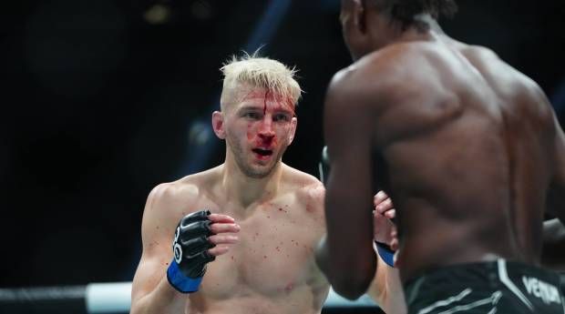 Sports Illustrated - Dan Hooker Posts X-ray of Broken…