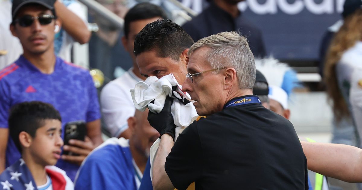 Assistant referee brutally hit in the face by ball in…