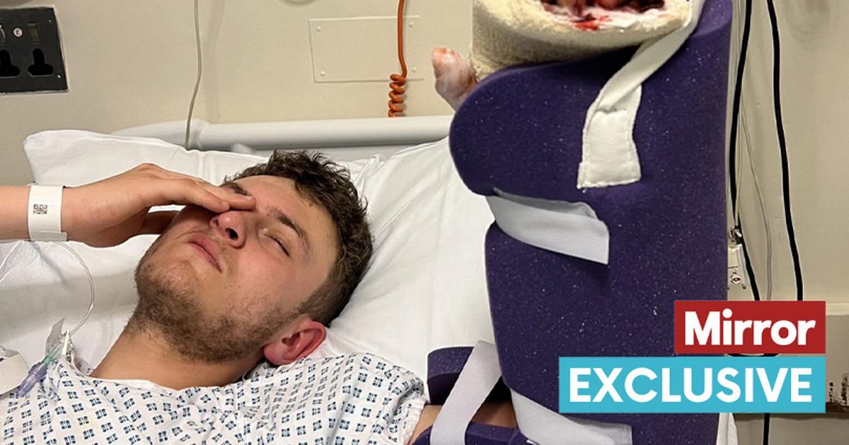 Man nearly dies after flesh-eating bacteria from 'tiny…