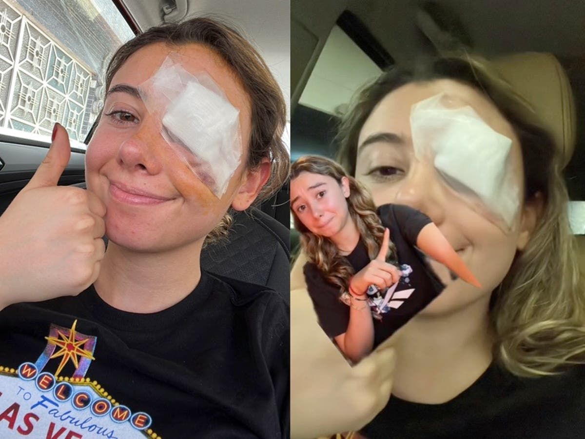 Woman requires eye surgery after using social media…