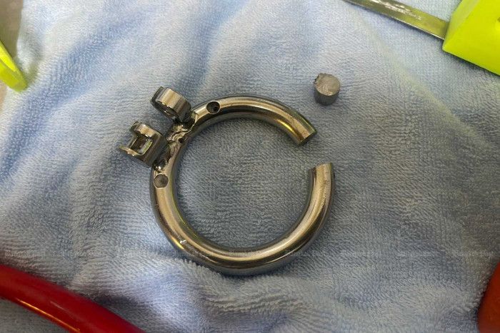 Sex Ring Removed From Tourists Body