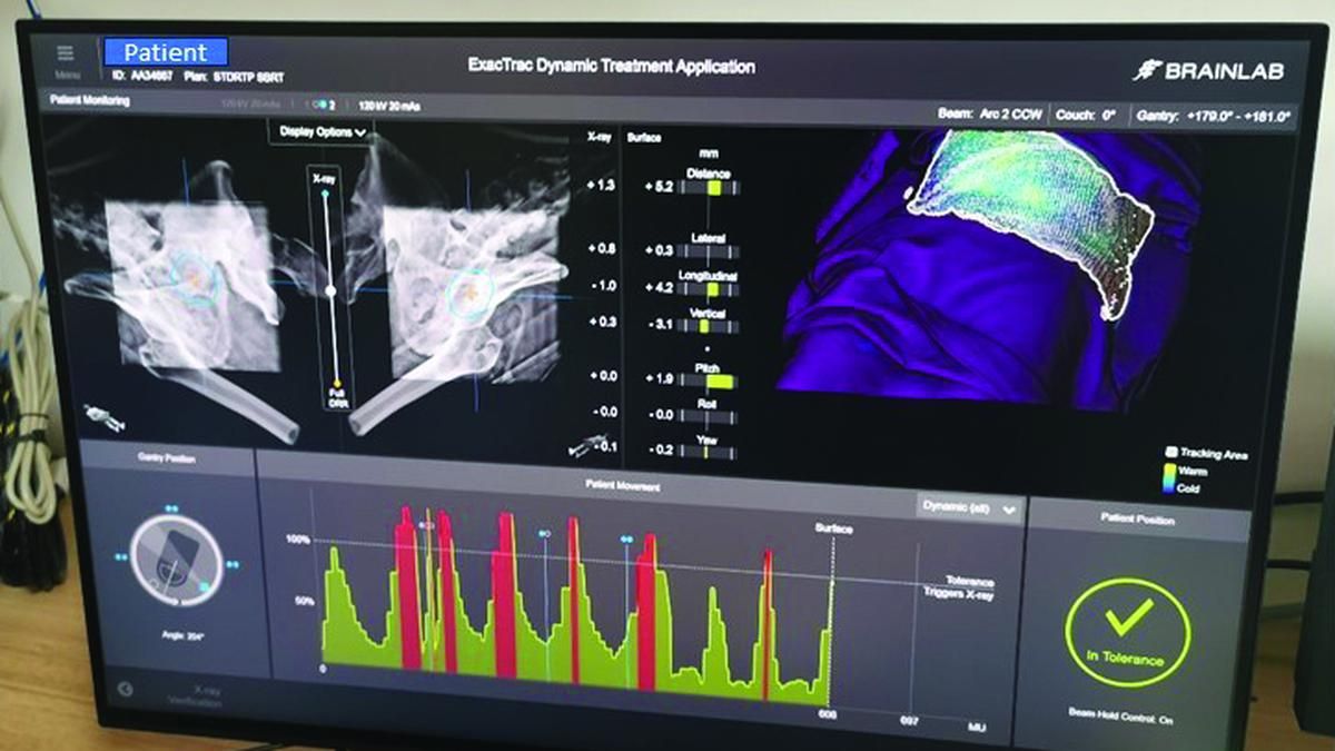 CMC, Vellore, introduces advance treatment for cancer…