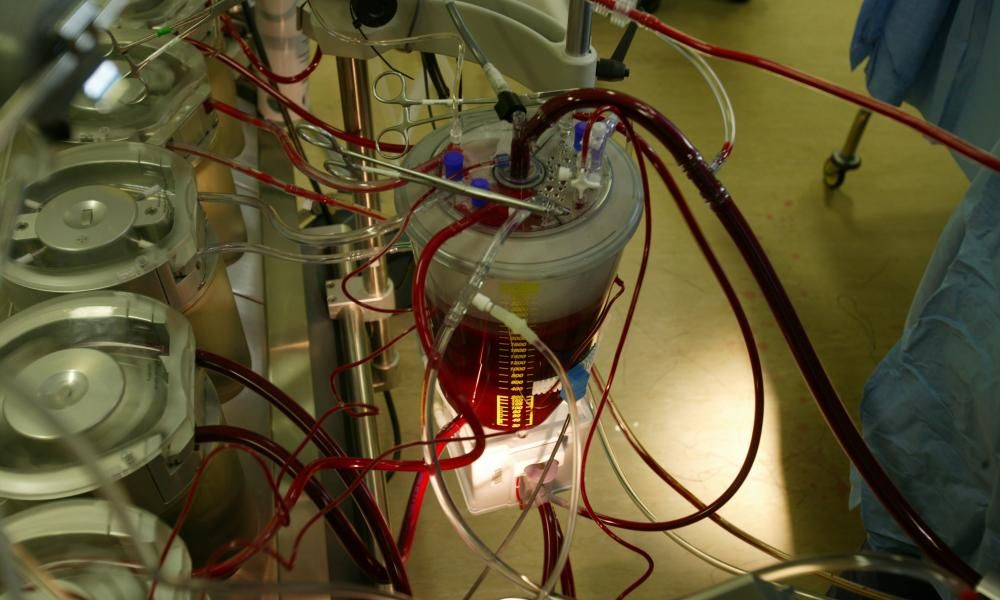 History of transplant breakthroughs: from hearts to…