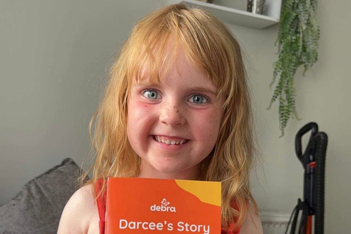 Darcee, 5, is cover star of book explaining her skin…