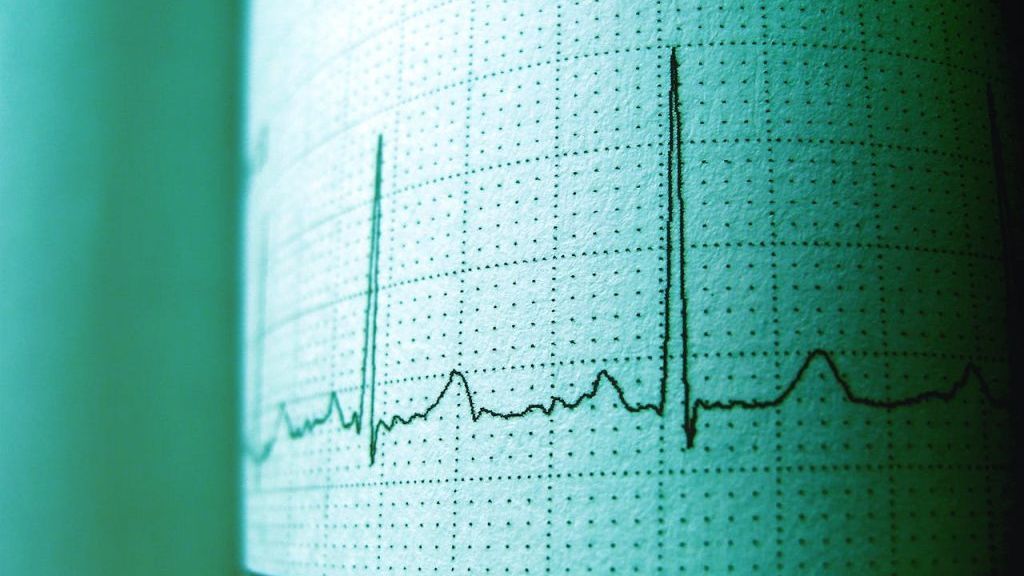 Wearable ECG Patch Revolutionizes Heart Monitoring For…