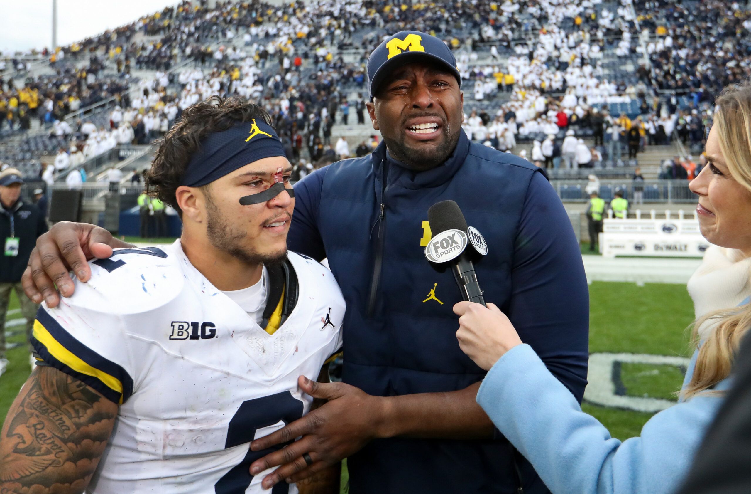 Michigan RB Blake Corum’s bloodied face epitomizes…