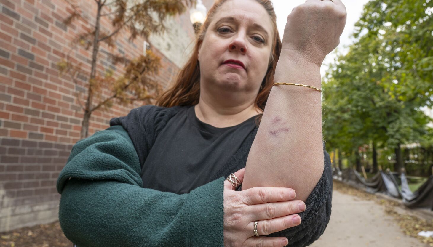 What to do if you’ve been bitten by a dog