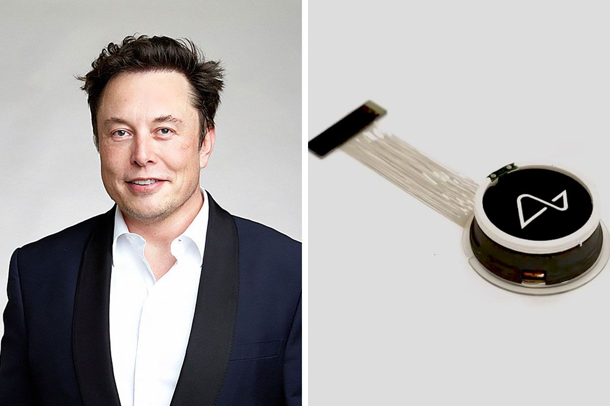 “That Is The Goal”: Elon Musk’s Neuralink Is Implanted…