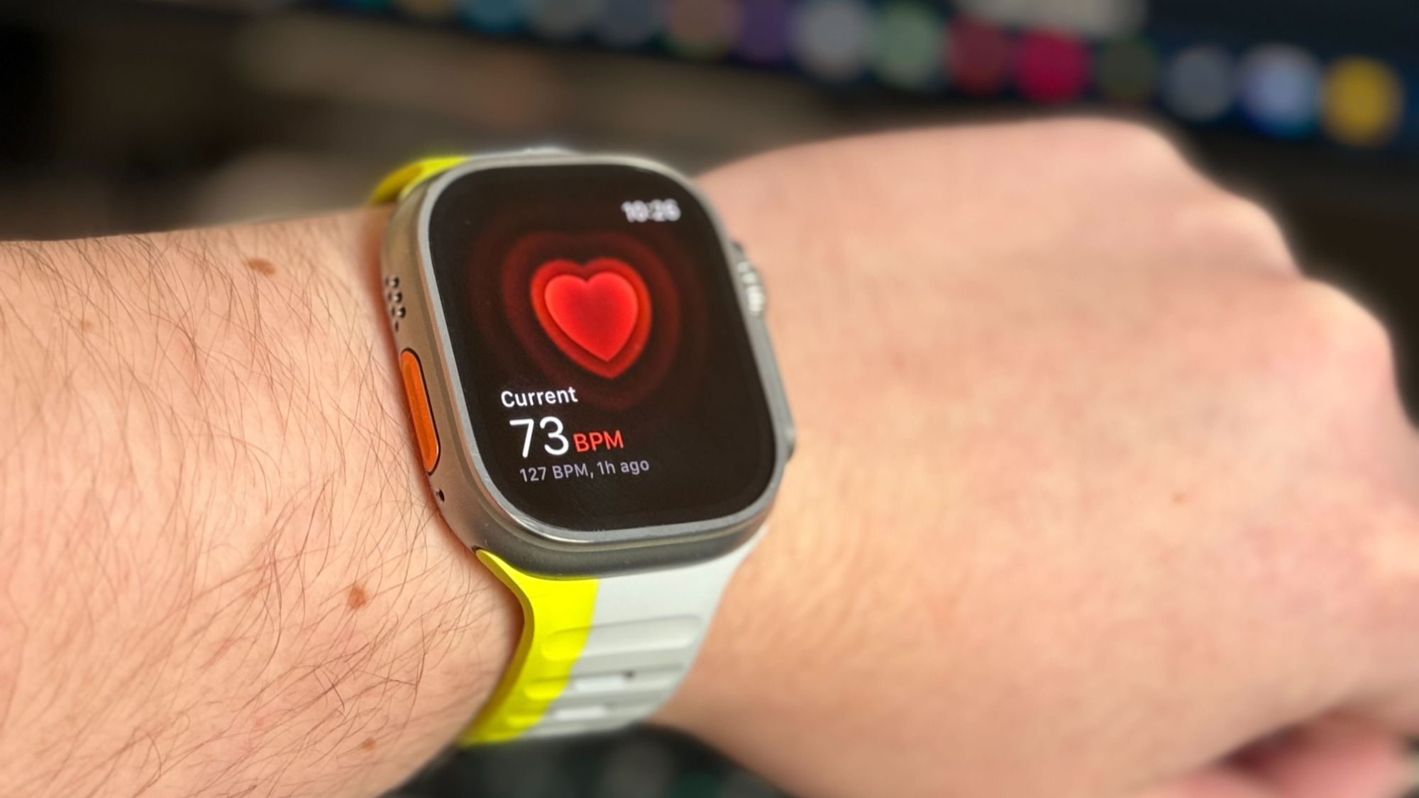 Apple Watch owner credits the device with helping him…
