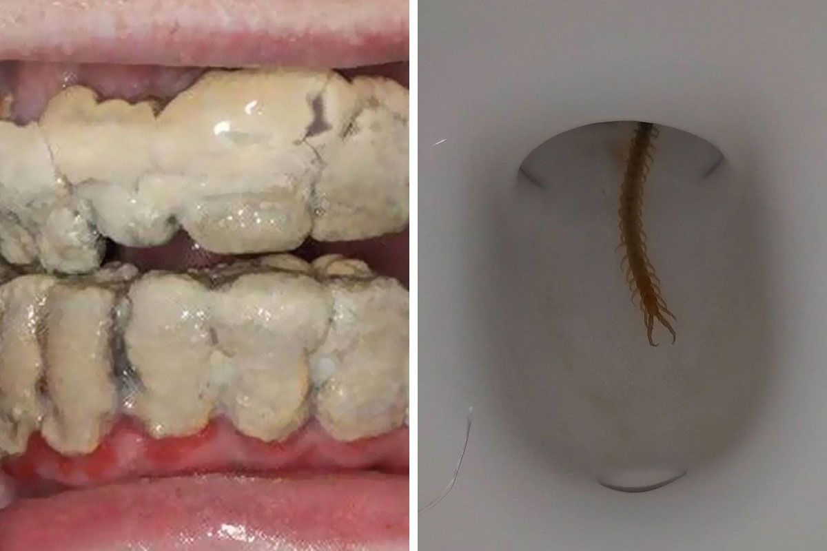 94 Disturbing Photos That Made People Suffer (New Pics)