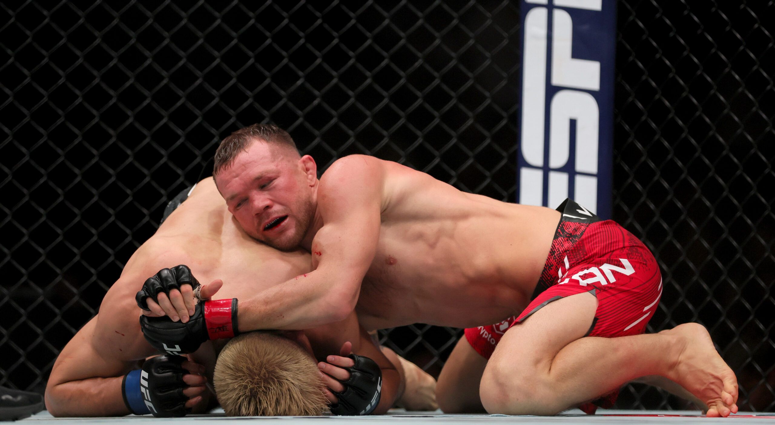 Petr Yan reveals multiple injuries after UFC 299 win,…