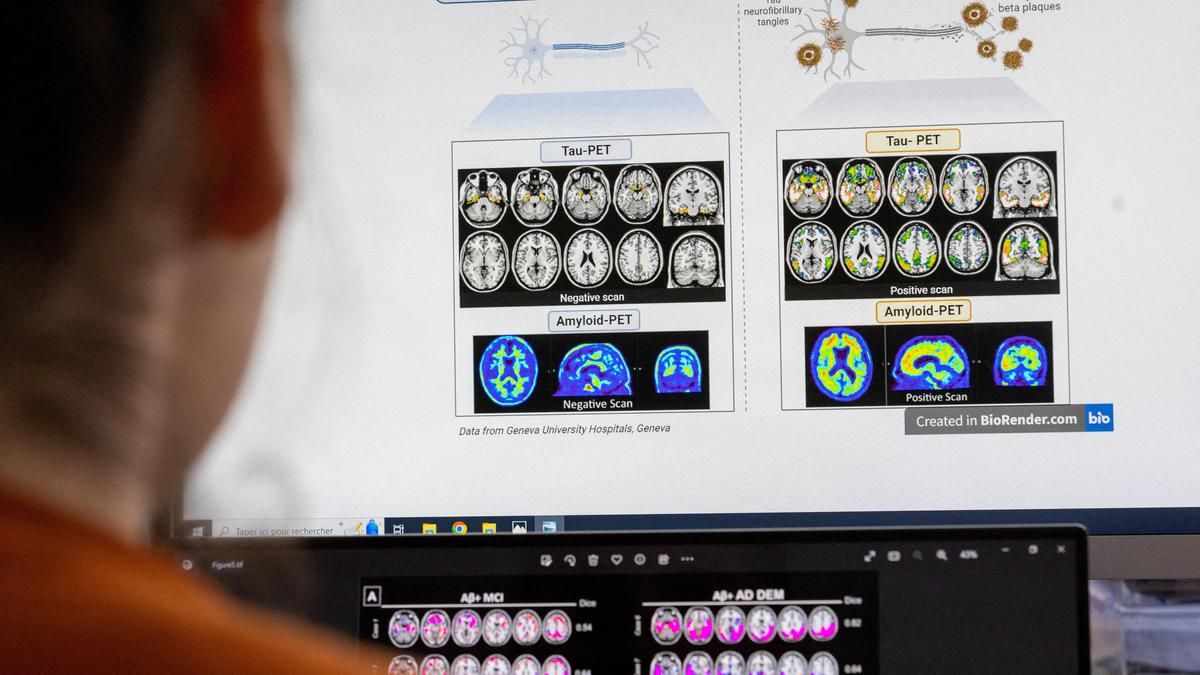 A century after the EEG was discovered, it remains a…
