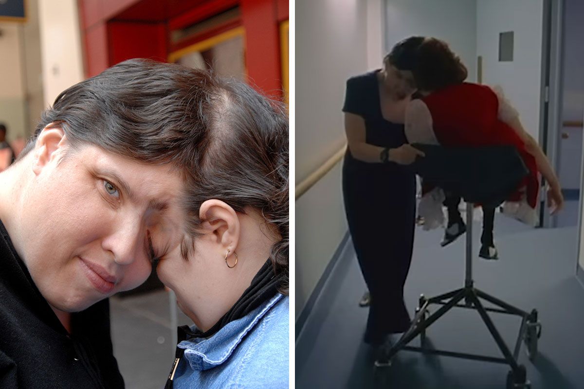 World’s Oldest Conjoined Twins, George And Lori, Pass…