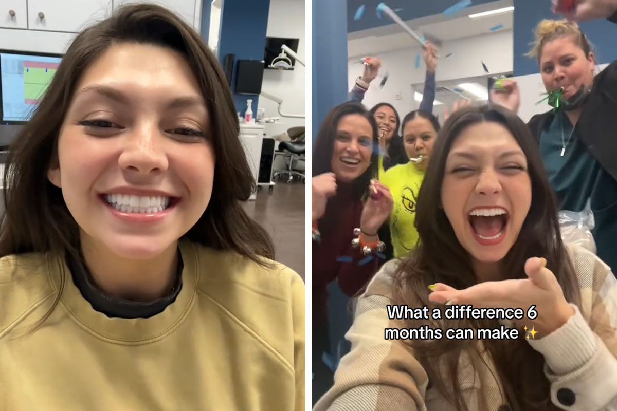 Woman’s Journey To Get New Teeth After Hers Were…