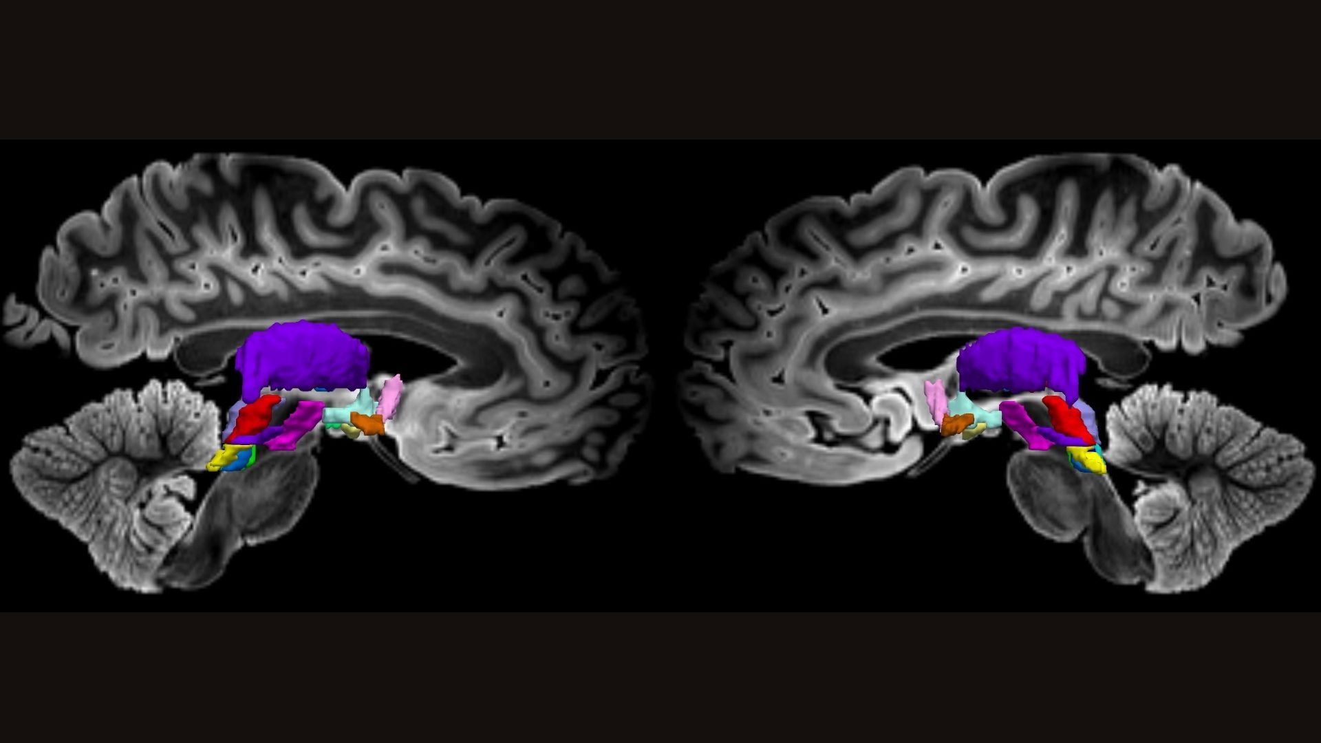 Super-detailed map of brain cells that keep us awake…
