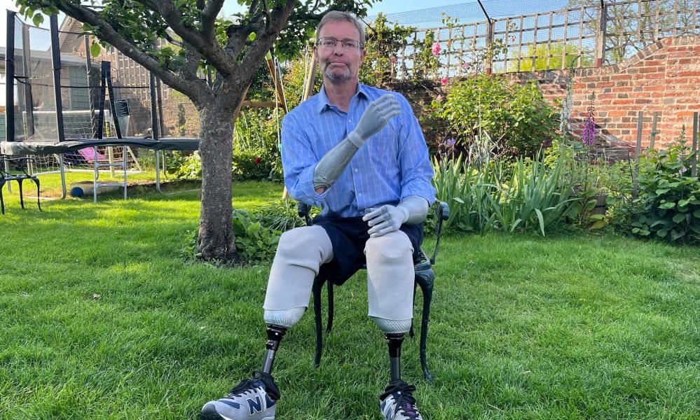 Tory MP Craig Mackinlay reveals his hands and feet…