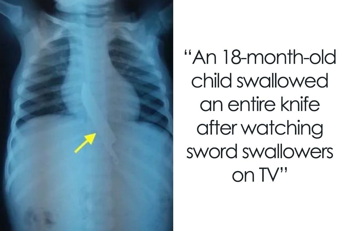 54 Of The Dumbest Kid Moments Adults Just Had To Share…