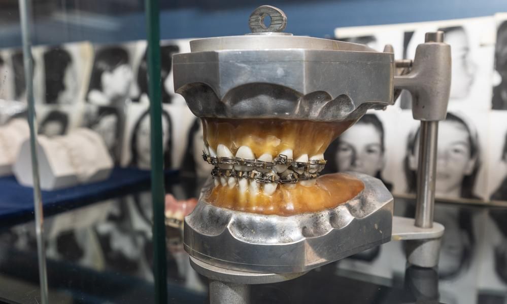 Oral history: how Tick Begg revolutionised braces and…