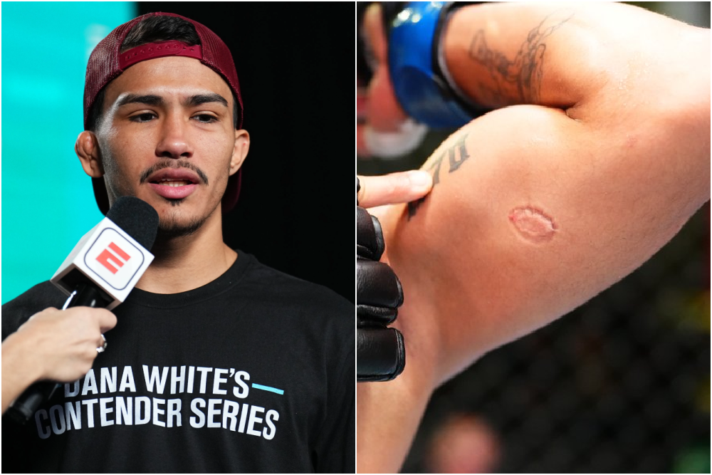 Igor Severino suspended nine months, fined $2K by NAC…