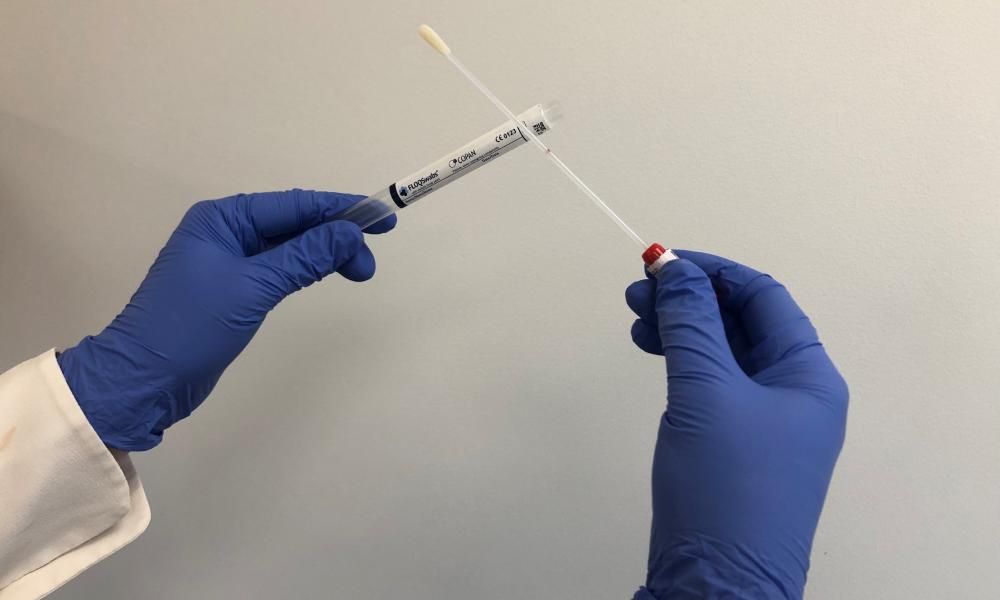 DIY smear tests are on their way? I’ll be first in the…