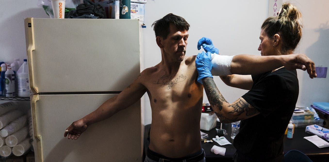 Xylazine wounds are a growing crisis among drug users…