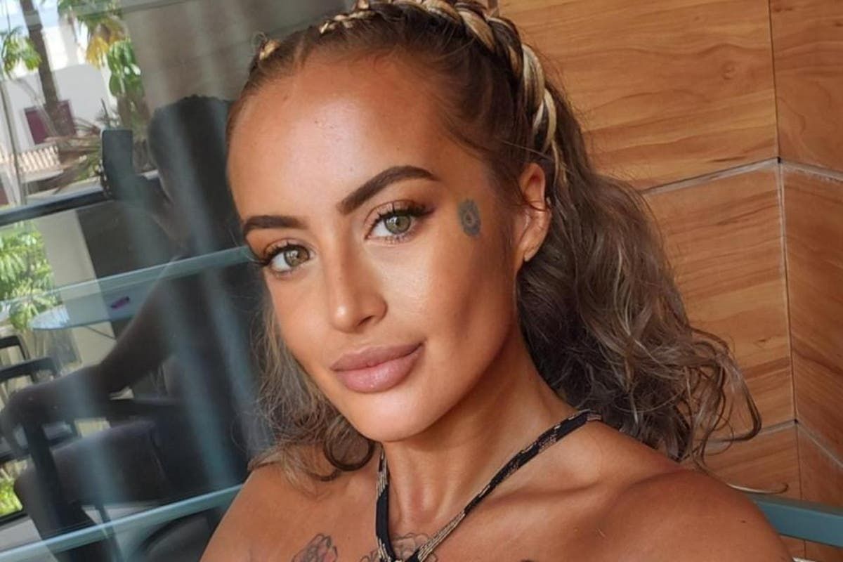 Woman bitten on arm by dog died the following day,…