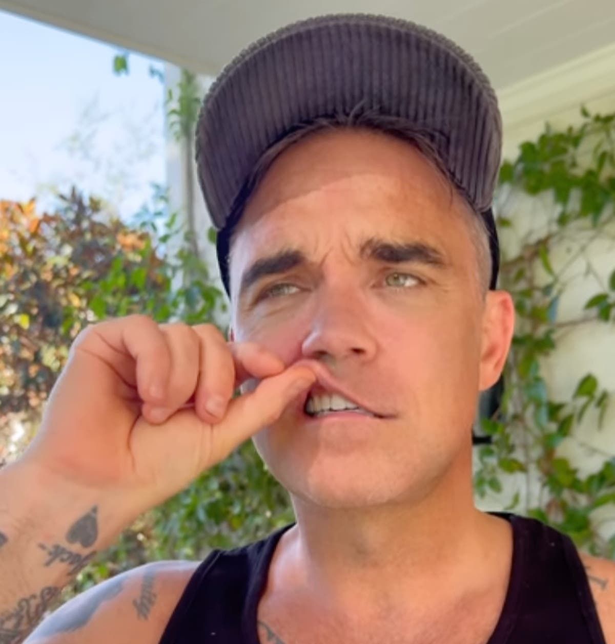 Robbie Williams complains about how his new teeth have…