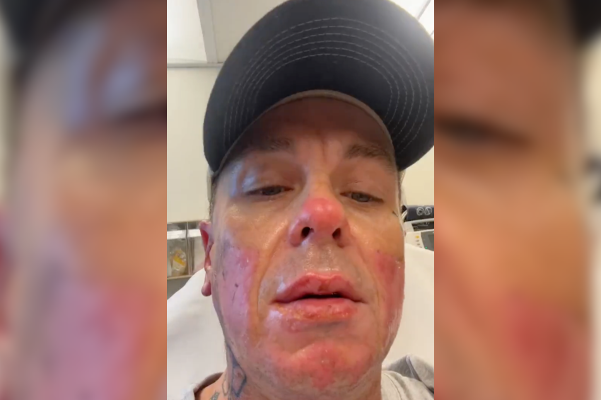 Slipknot’s Sid Wilson details gruesome injuries from…